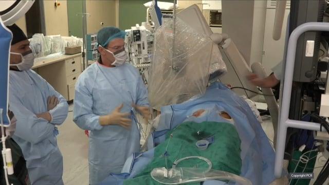 LAA (Left Atrial Appendage) closure